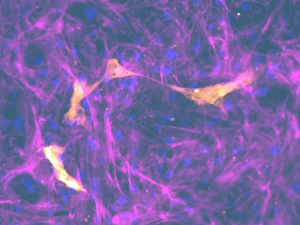 Lung on a chip | In vitro Lung Models | Lung MPS | CN Bio