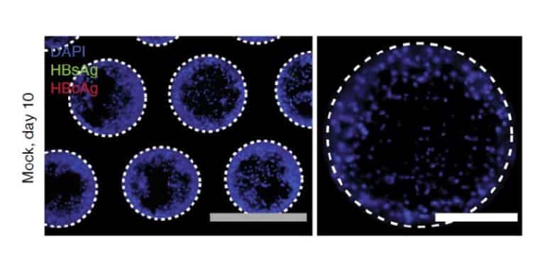 Recreate the full Hepatitis B Life Cycle | In Vitro 3D Liver