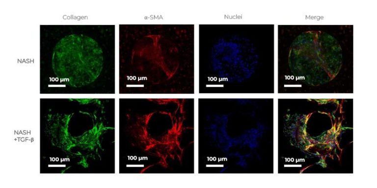 PhysioMimix In Vitro Human MASH/NASH Fibrosis Assay | CN Bio