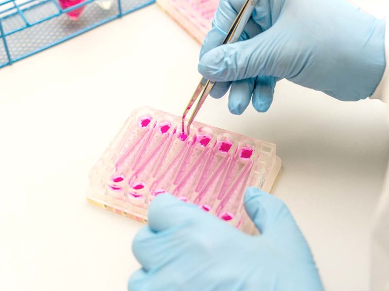 Human Organ-on-a-Chip Applications | PhysioMimix® | CN Bio