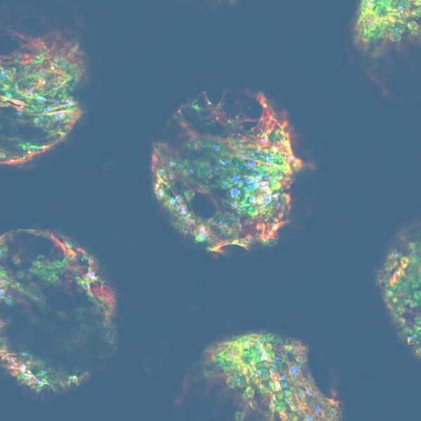 De-Risk DILI | In Vitro Hepatotoxicity Services | CN Bio