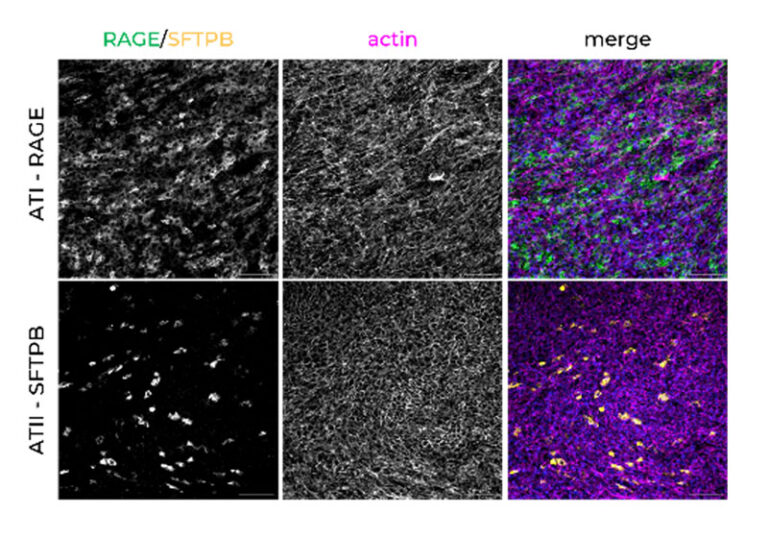 Lung on a chip | In vitro Lung Models | Lung MPS | CN Bio