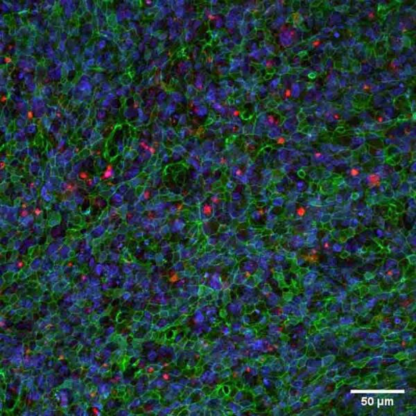 Lung on a chip | In vitro Lung Models | Lung MPS | CN Bio